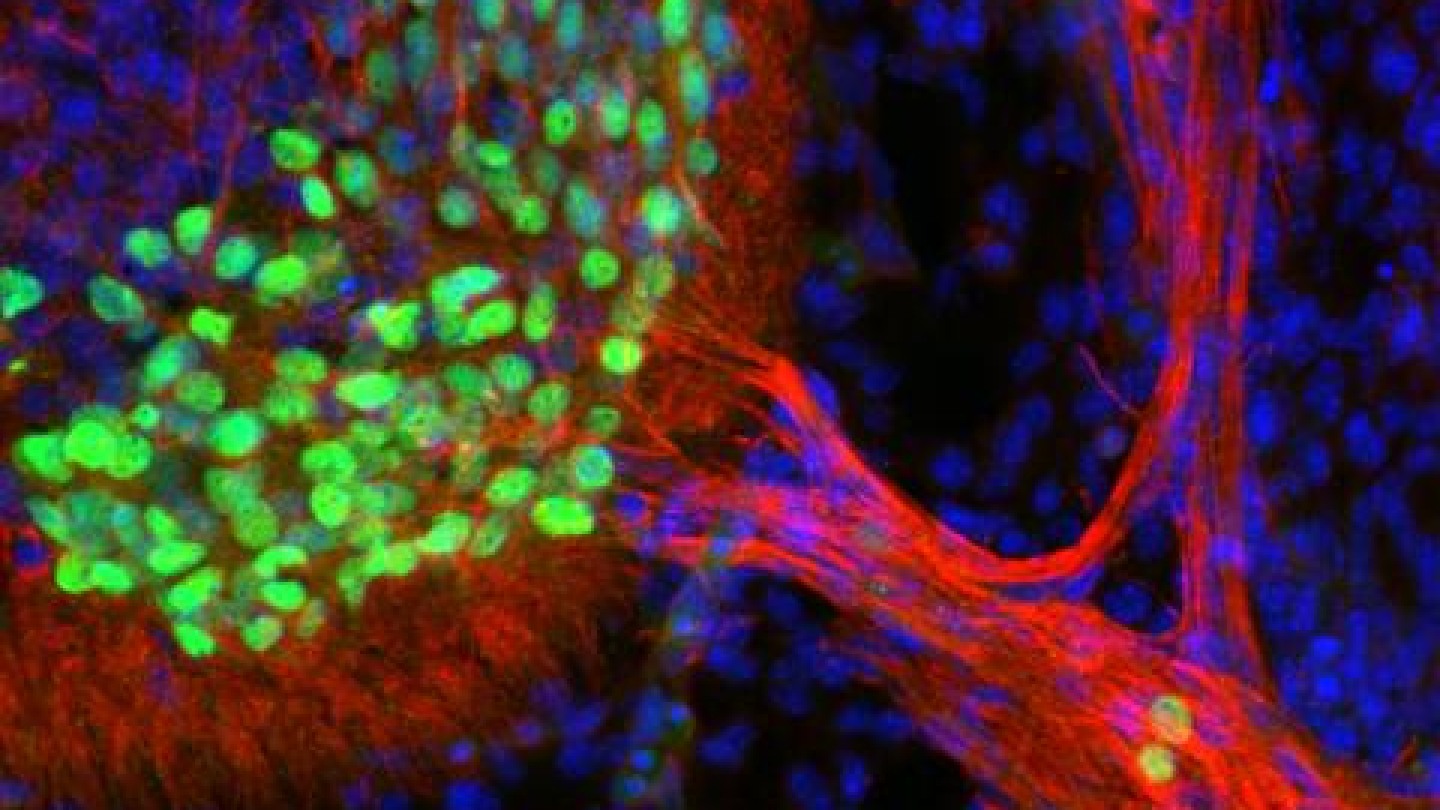 Parallel control of multiple steps in motor neuron wiring by TAG-1 ...