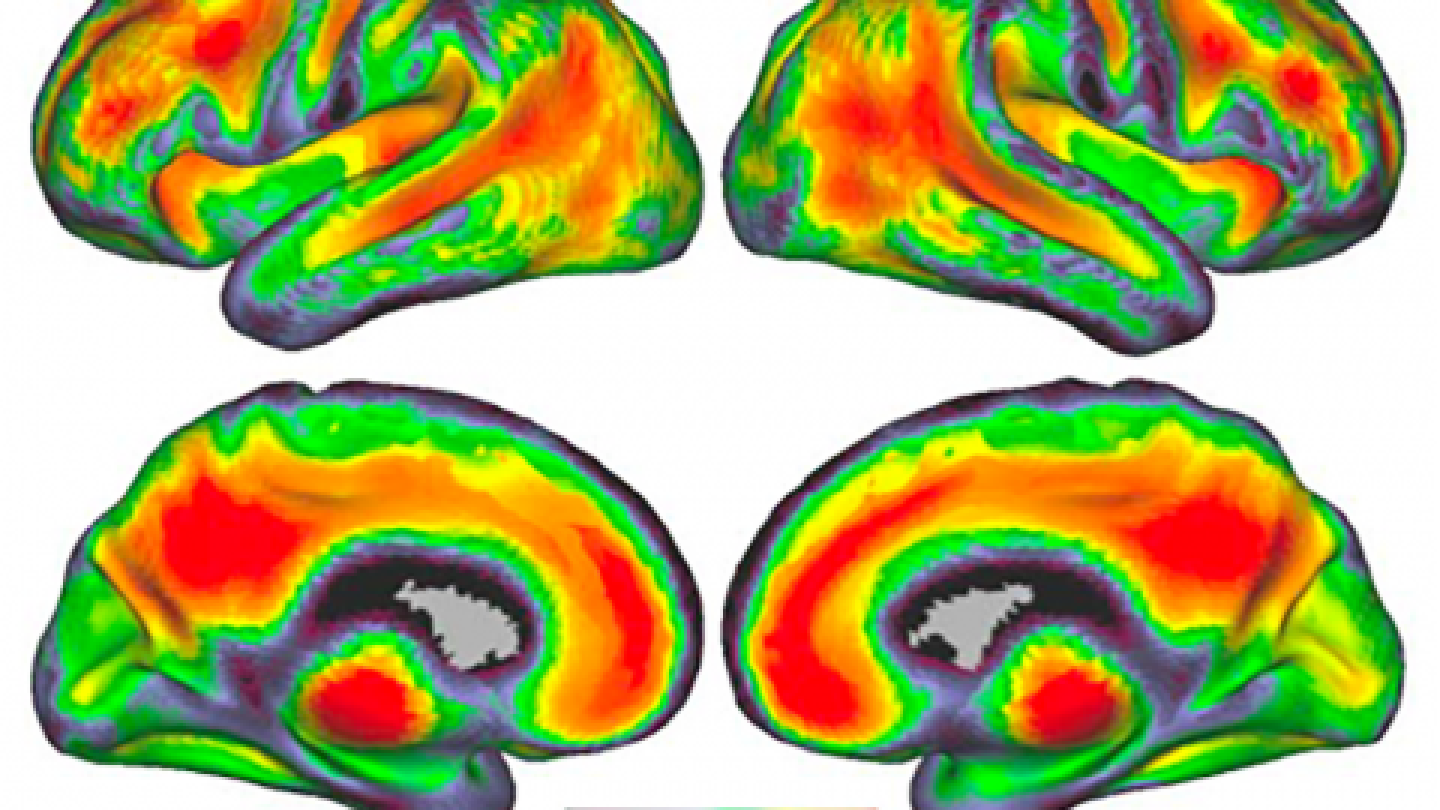Developing novel cognitive and neuroimaging markers of preclinical ...