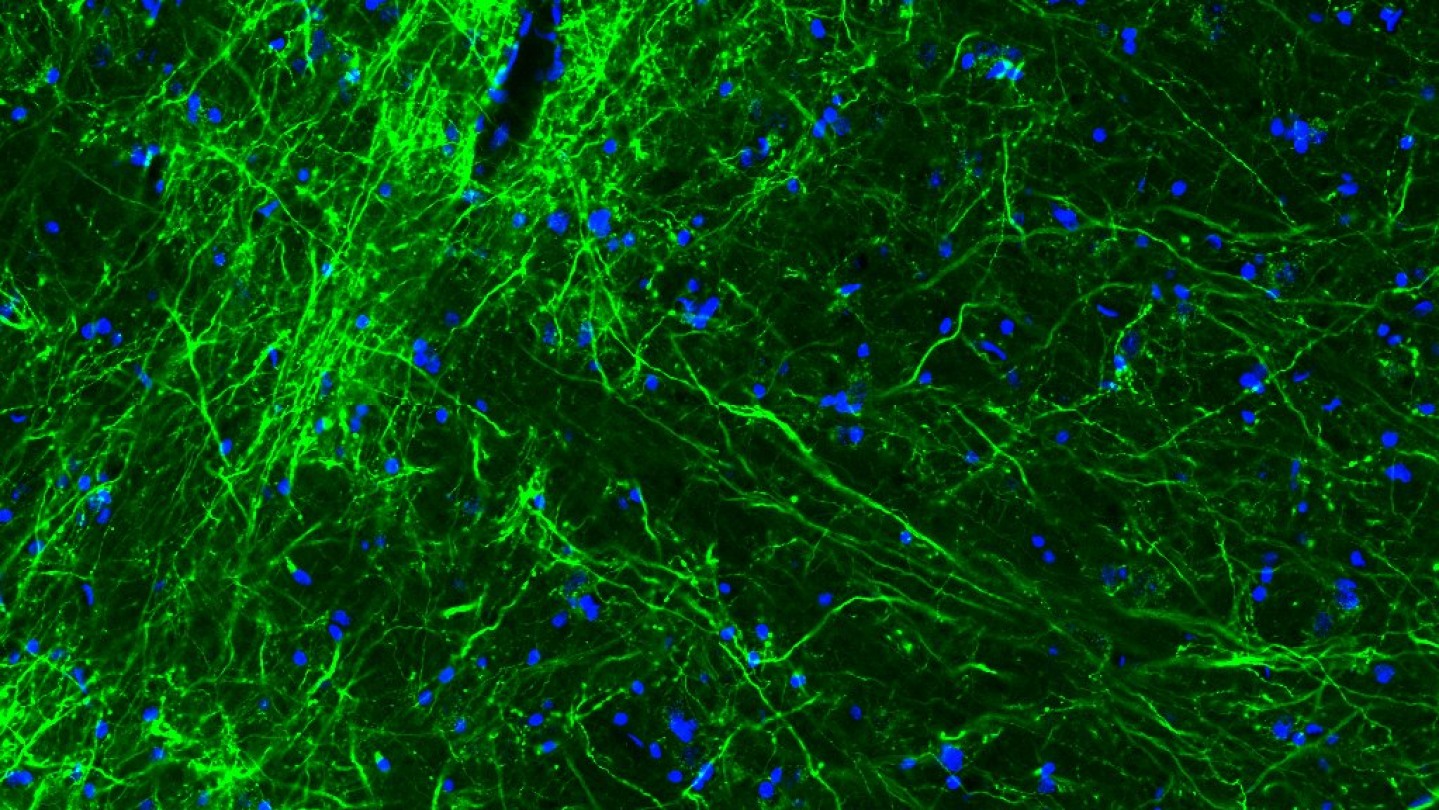 Study finds systematic wave-like pattern of dopamine’s signaling in ...
