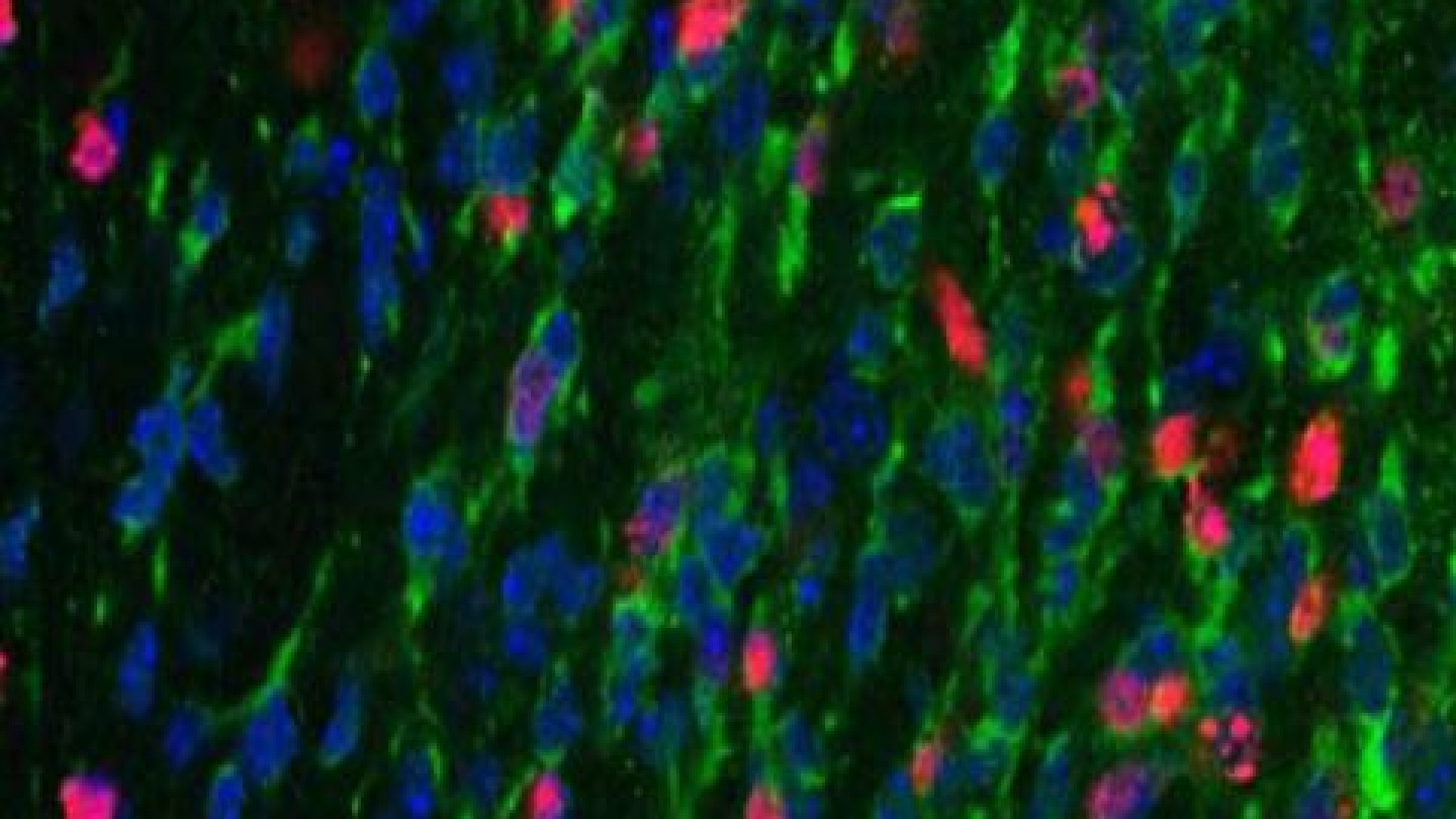 Activating dormant neural stem cells in the adult and aged brain ...